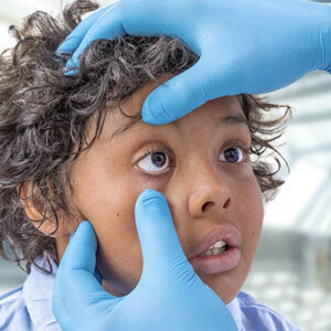 Resources for ocular infections | Keep Eyes In Sight